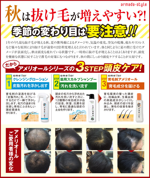 タカの「触れにくいハゲの話」 | 世田谷喜多見の美容院 CORASON（コラソン）